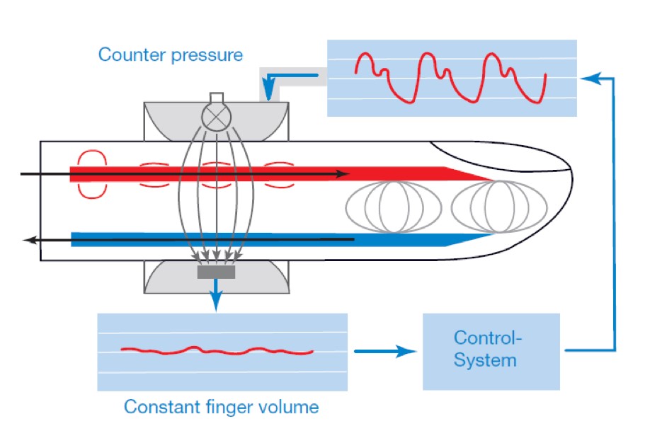 Measurement of Blood Pressure and Cardiac Output – Physics4FRCA