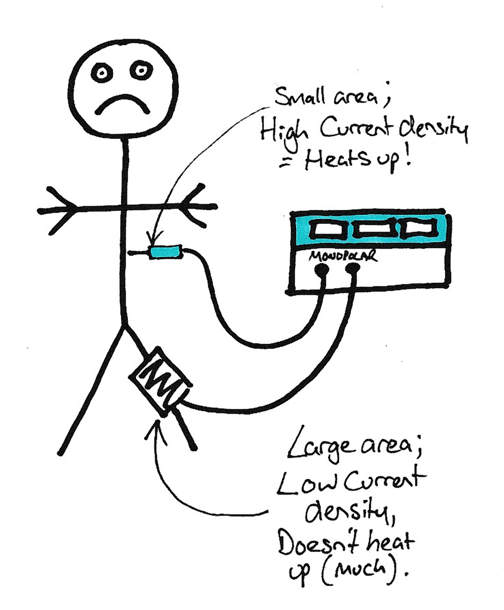 Diathermy – Physics4FRCA