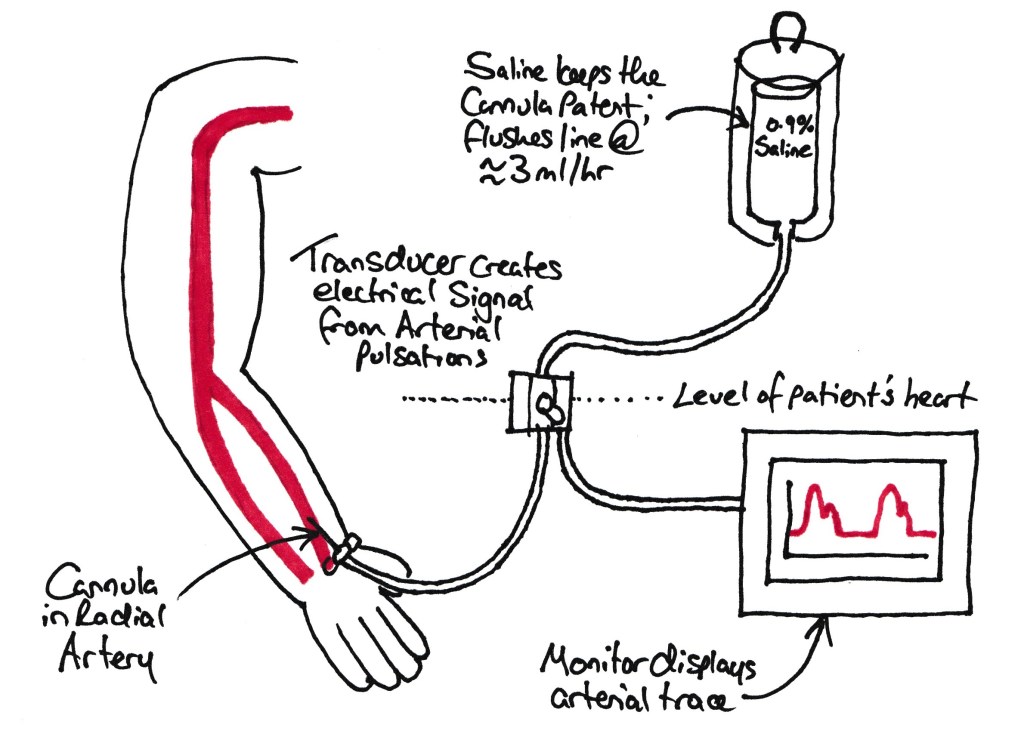 Measurement of Blood Pressure and Cardiac Output – Physics4FRCA
